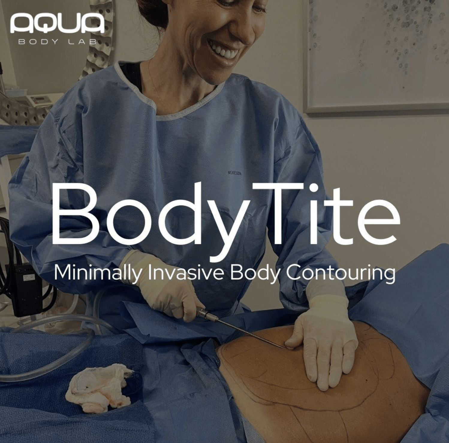 Discover BodyTite Pro for Body Contouring